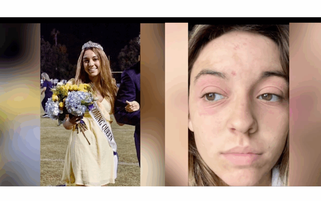 Is Mold Exposure Making You Sick? Ashley’s Story Reveals the Hidden ...